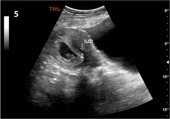 The Perils of Premature Closure | Emergency Physicians Monthly