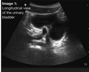 Second Chance on Bladder Ultrasound | Emergency Physicians Monthly