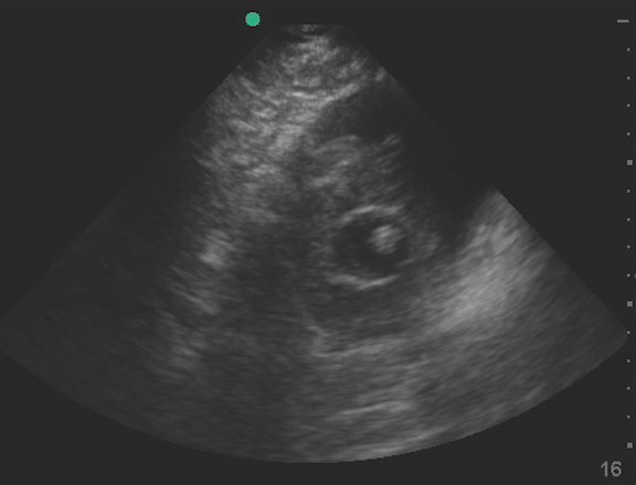 Finding the Foley | Emergency Physicians Monthly