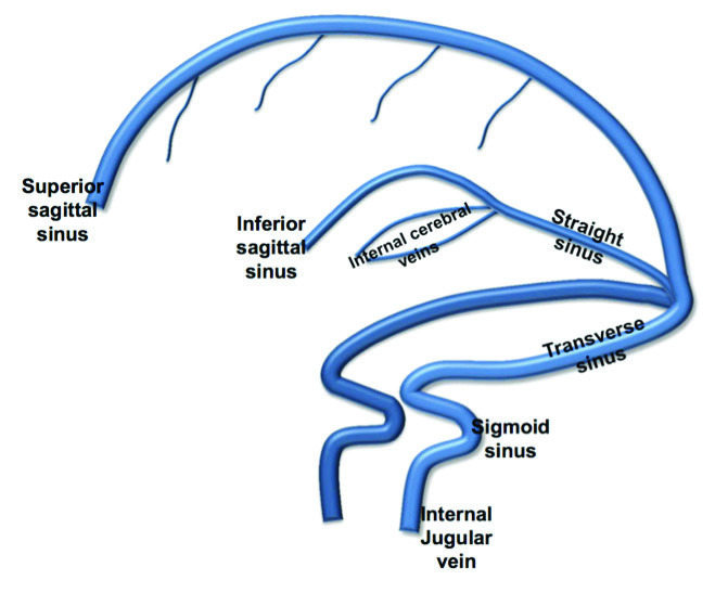 Cerebral Venous Thrombosis | Emergency Physicians Monthly