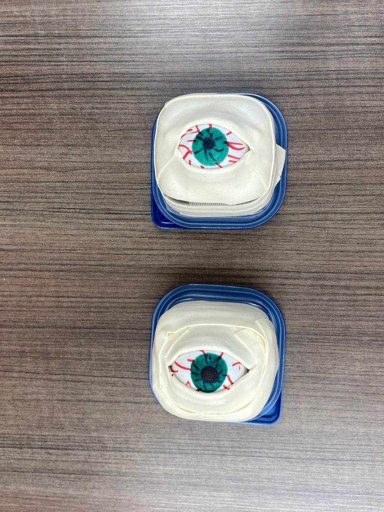 Train Yourself: Lateral Canthotomy