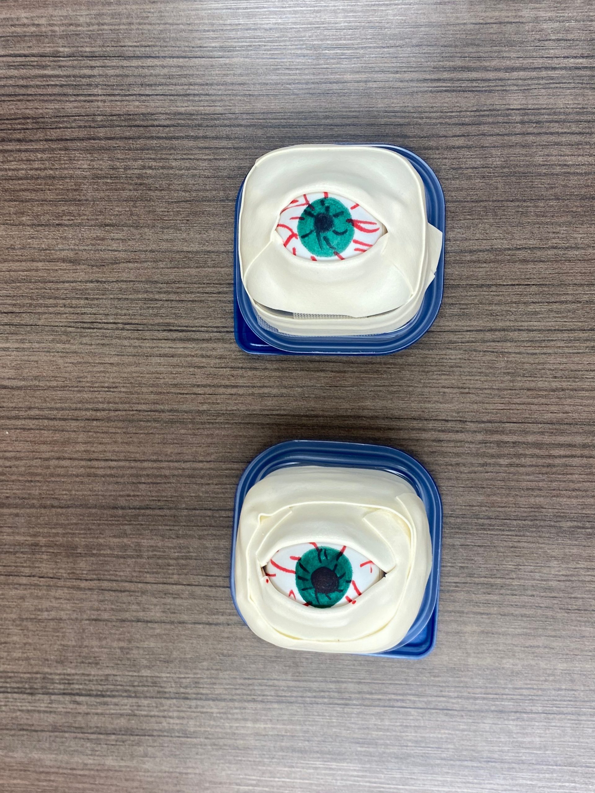 Train Yourself: Lateral Canthotomy