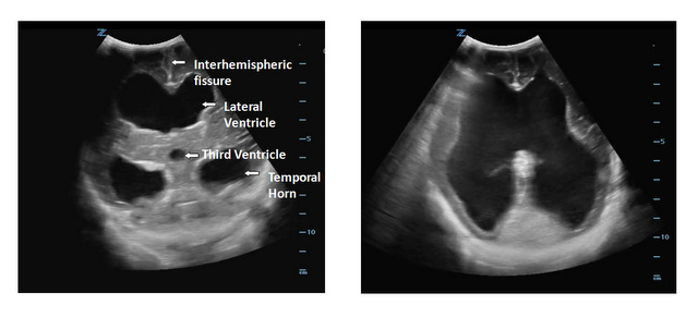 Big Head, Big Problems! | Emergency Physicians Monthly
