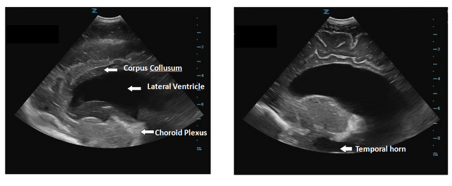 Big Head, Big Problems! | Emergency Physicians Monthly