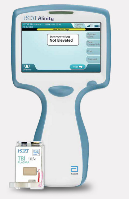 A blood test for concussion | Emergency Physicians Monthly