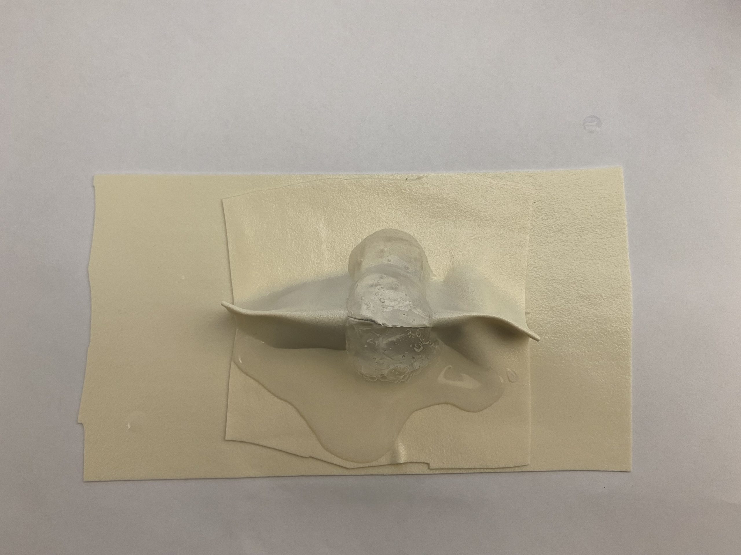 Train Yourself: Incision and Drainage | Emergency Physicians Monthly