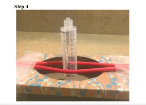 Train Yourself: Getting a Hand on Chest Tube Thoracostomy | Emergency ...