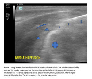 Hot elbow and 3-point crawl | Emergency Physicians Monthly