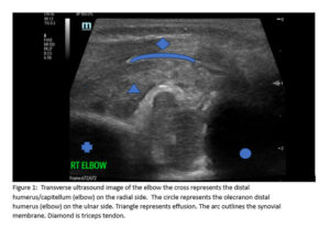 Hot elbow and 3-point crawl | Emergency Physicians Monthly