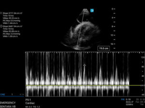 Op-Ed: Why Sensitivity Matters More Than Specificity in Identifying ...
